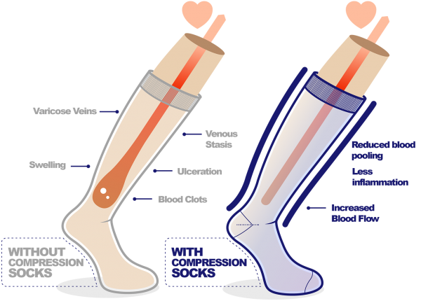 Graduated Compression Travel Socks for Travelers - Travelsox